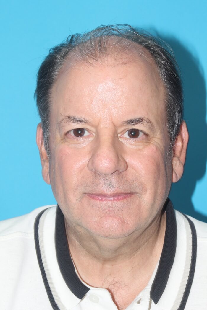 Before and After Photos Scottsdale, Arizona - Plastic Surgery Gallery ...