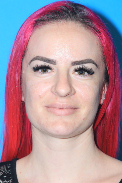 Before and After Photos Scottsdale, Arizona - Plastic Surgery Gallery ...